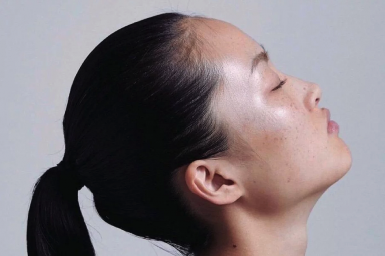 Zara advert featuring model Li Jingwen's freckles slammed for ...