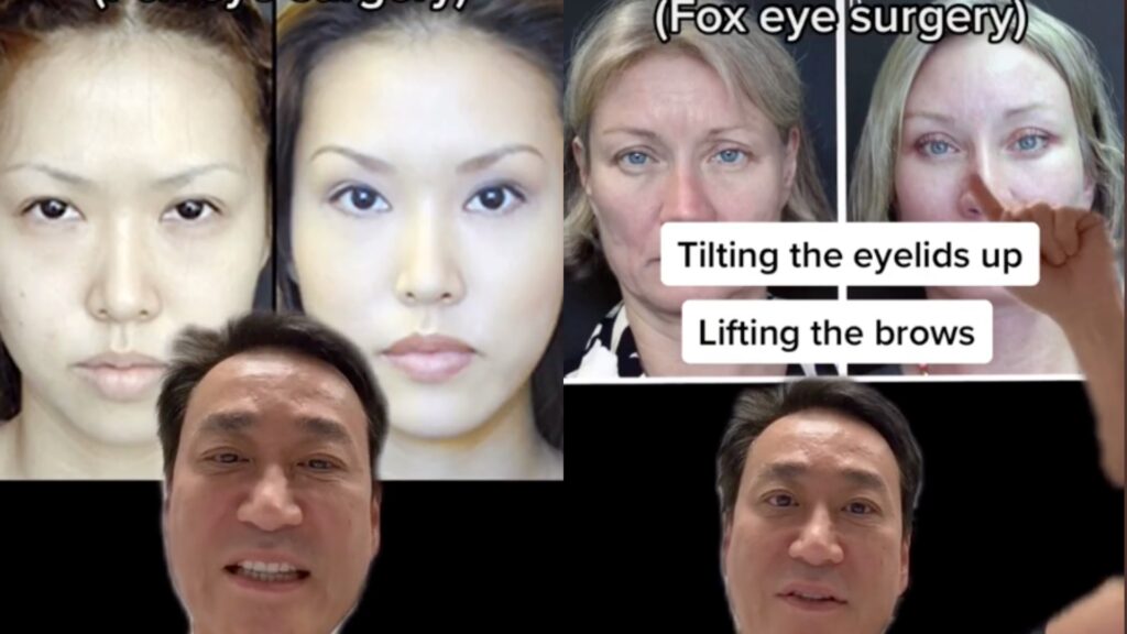 Plastic surgeon proves 'fox eye' trend was inspired by Asian features